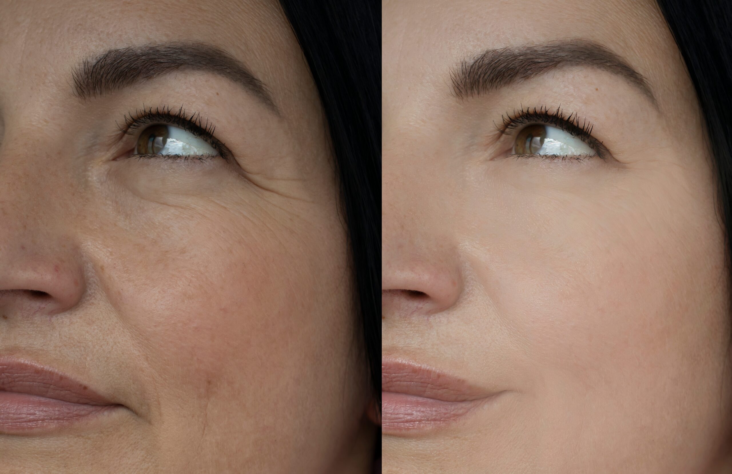 How To Improve Skin Tightness and Restore Youthful Glow